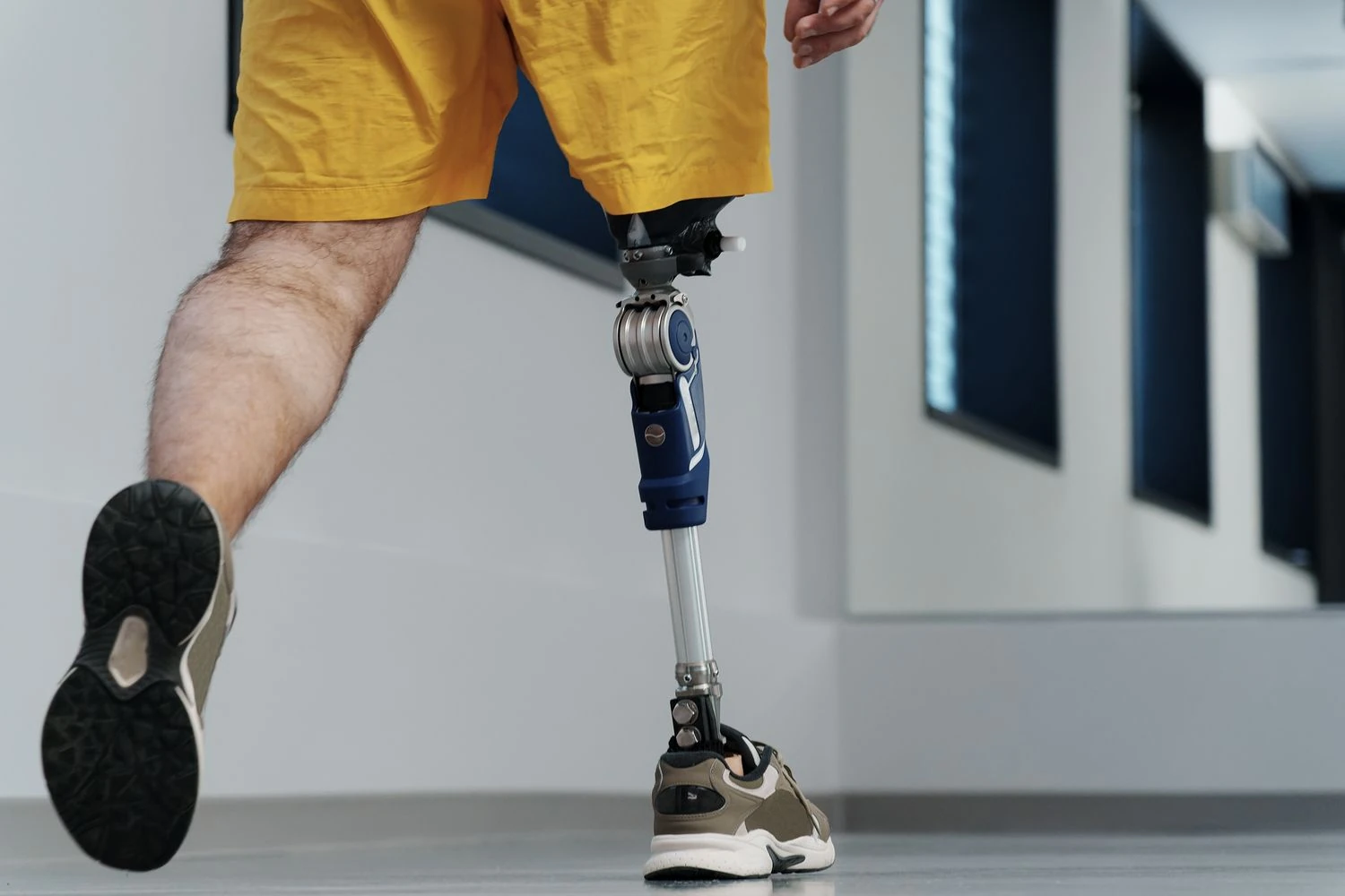 The Andrii Matiukha Foundation helped launch the digital hub "YE-PROTEZ ...