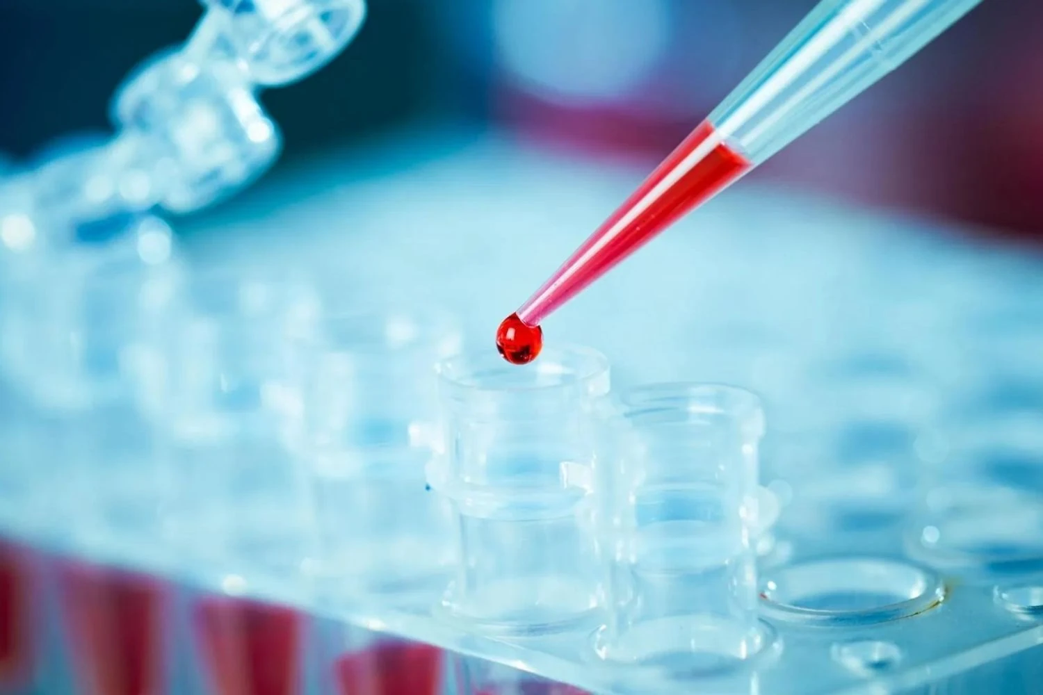 Scientists discover antibody that blocks almost all variants of HIV ...