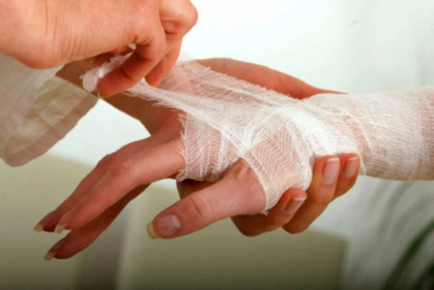 First aid for burns: what really works and what is forbidden to do | УНН